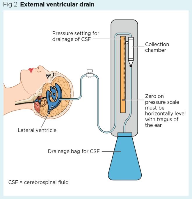 Why it's not a good idea to keep vitamin B12 a secret: case report of ...