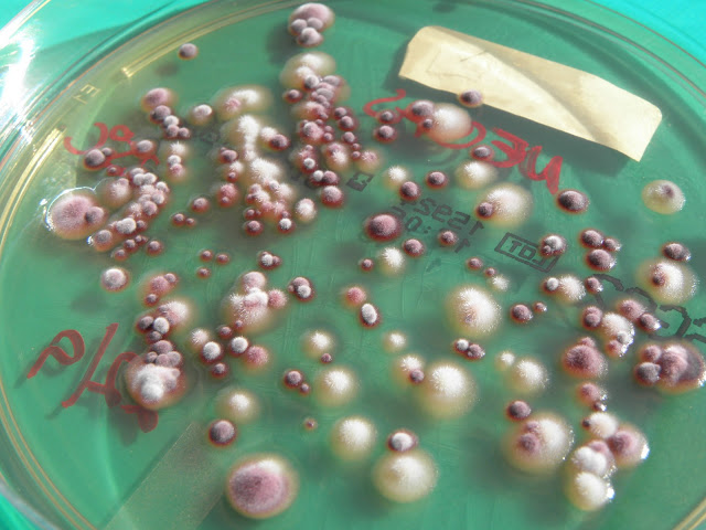 ATLAS MICOLOGIA: TRICHOPHYTON VIOLACEUM