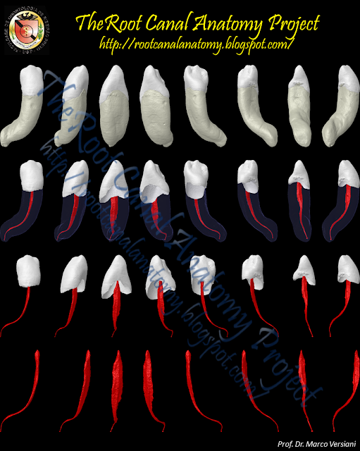 The Root Canal Anatomy Project: Mandibular Canine