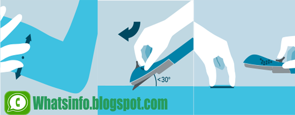 Implanon Removal Procedure