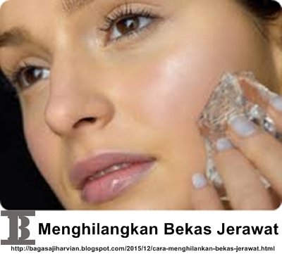 Cara Menghilangkan Bekas Jerawat secara Alami dengan Cepat dan Mudah ...