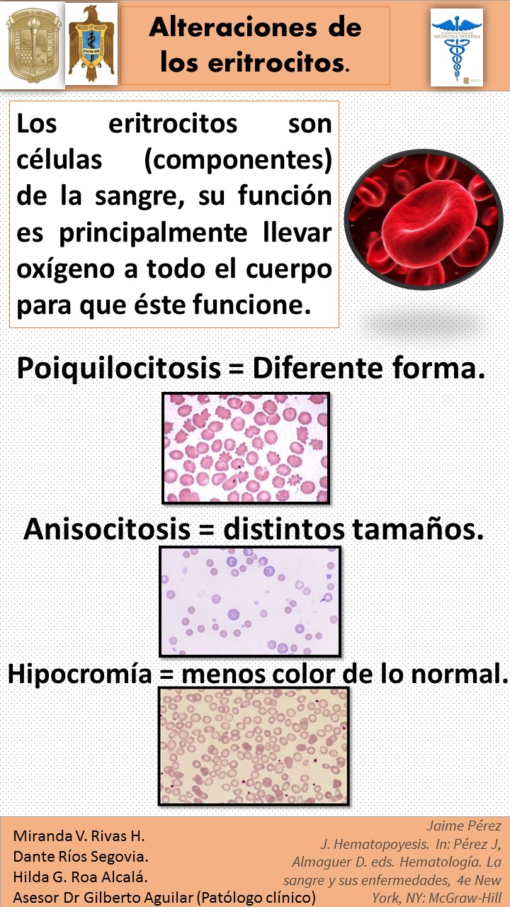 Erythrocyte abnormalities. - DIVULGACIÓN CIENTÍFICA UG