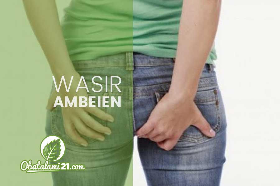 Penyebab dan Gejala Wasir Serta Cara Mengobatinya | Obat Alami