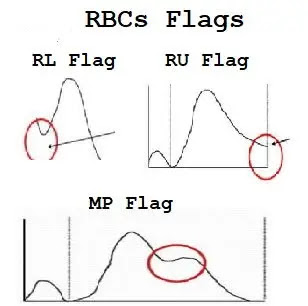 Automation in hematology Part (2)