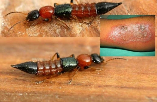 [VIDEO] Nairobi Fly -Millions of Narrow Bee Flies ' Nairobi Flies ...