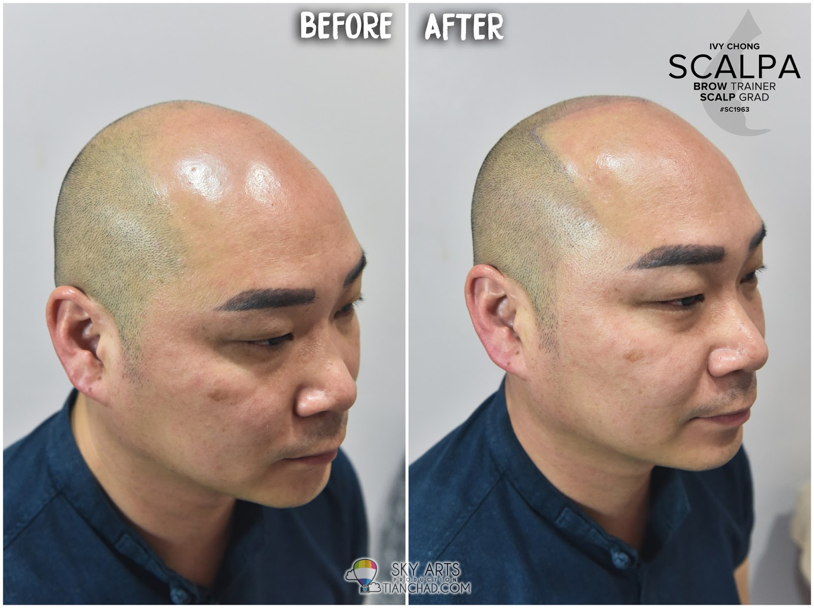 Best Scalp Micropigmentation (SMP) in Malaysia | SMP 让你不再为秃头而烦恼