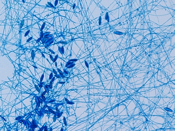 Fun With Microbiology (What's Buggin' You?): Microsporum gypseum