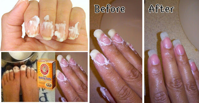 Simple recipes Health: Baking soda for nails