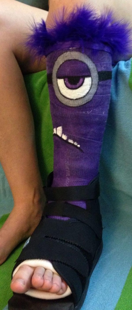 funny things to put on a cast - Creative DIY