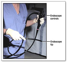 Kakchah Mega: ENDOSCOPY: MASUK KAMERA DALAM PERUT (BAHAGIAN II)