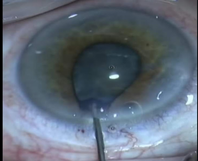 Médico Residente Oftalmólogo