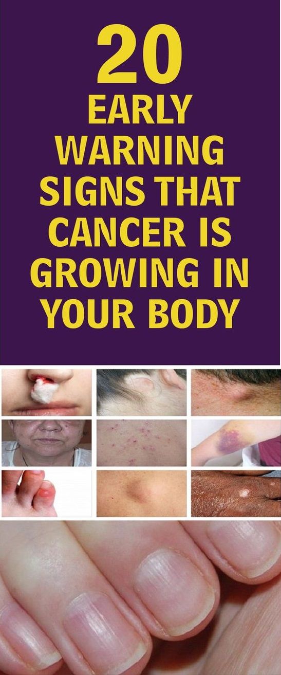Early Warning Signs That Cancer Is Growing In Your Body! - healhty and tips