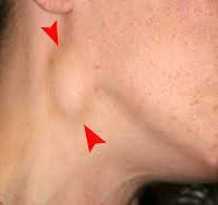 Clinical Examination of Respiratory System