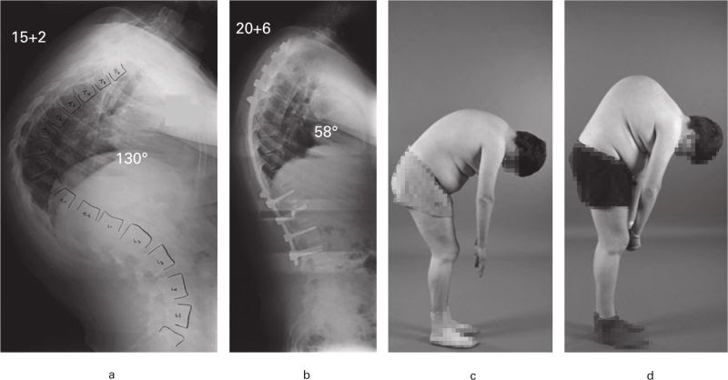 Revisiones_bibliográficas TyO_Web: El tratamiento quirúrgico de la ...
