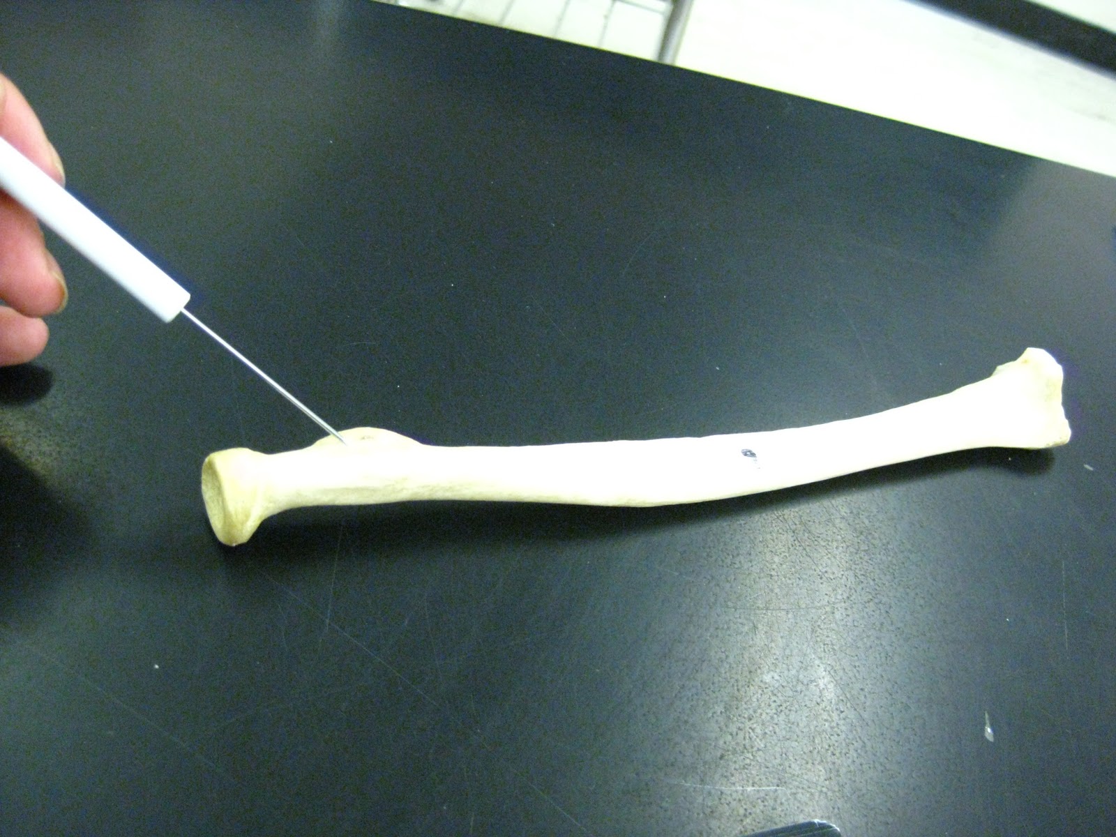 Styloid Process Foot