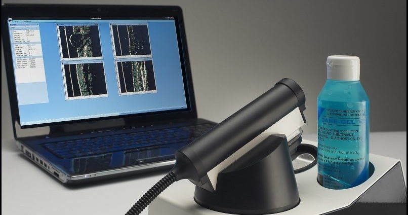 Cortex Technology DermaScan C USB Series Skin ultrasound