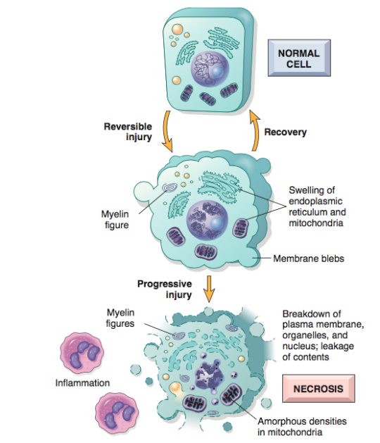 Cell Injury, Cell Death, and Adaptations