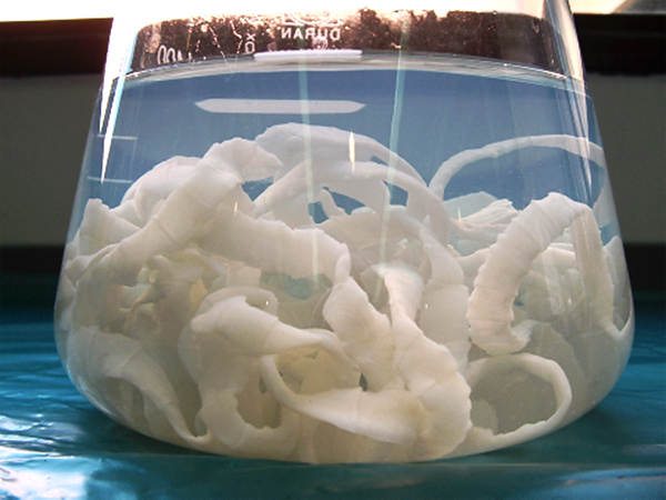 Microbiología y Parasitología: Teniasis