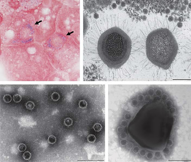 Virophage: Virus Menginfeksi Virus - SIAP UJIAN