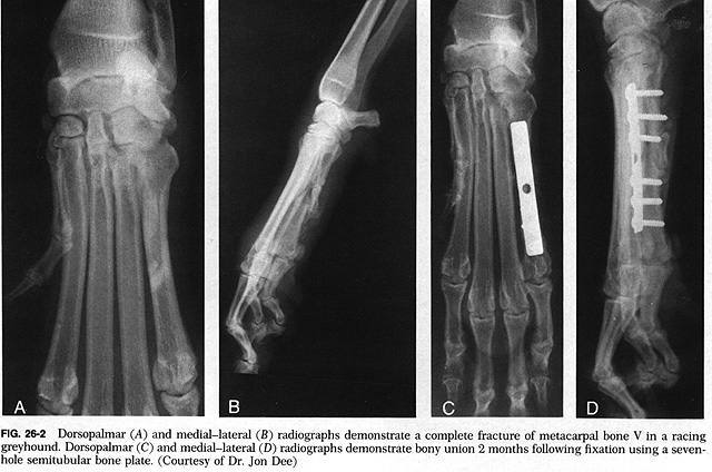 .: Surgical bone plates and screws