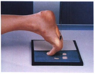 TANGENTIAL PROJECTION: TOES-SESAMOIDS - RadTechOnDuty