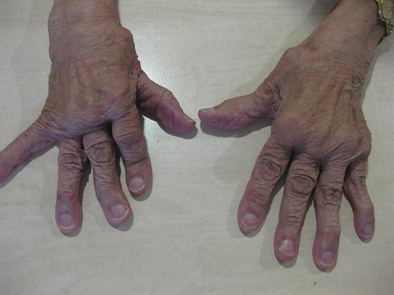 VILETANOS: abril 2011