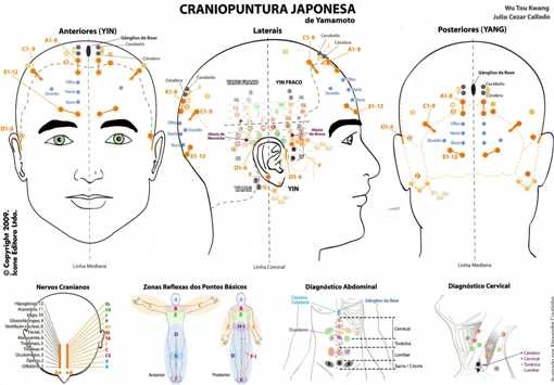 KLINIK AKUPUNKTUR ZANG FU: YAMAMOTO'S NEW SCALP ACUPUNCTURE
