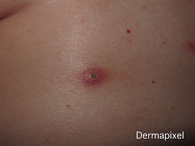 Dermapixel: abril 2020