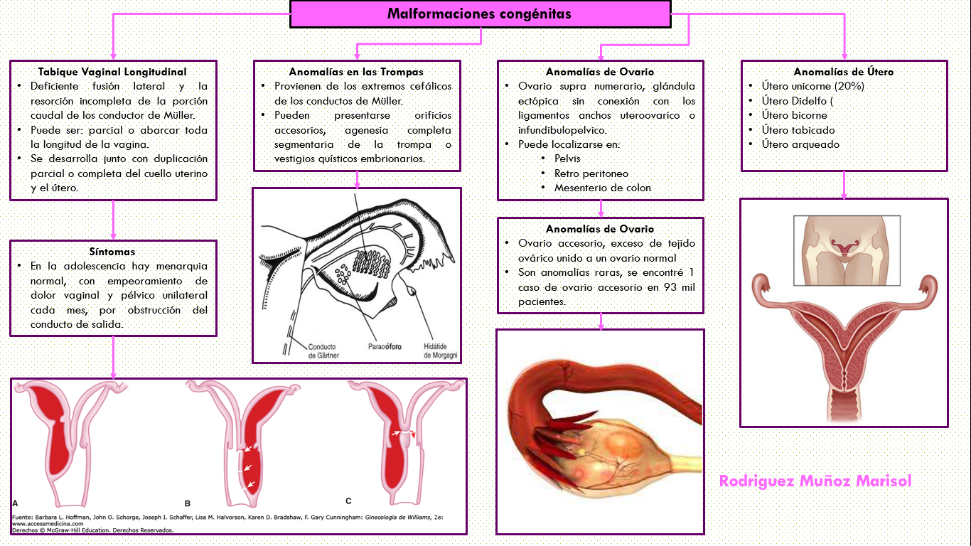Malformaciones congénitas del aparato reproductor femenino