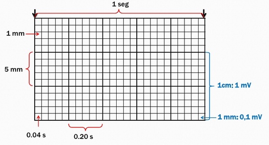 Amanecer Cada Día: ELECTROCARDIOGRAMA