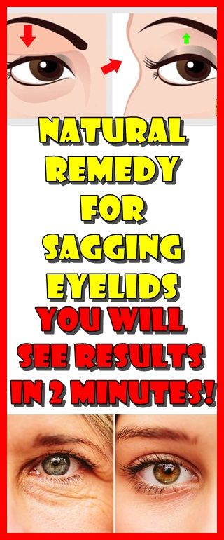 Natural Remedy For Sagging Eyelids You Will See Results In 2 Minutes ...