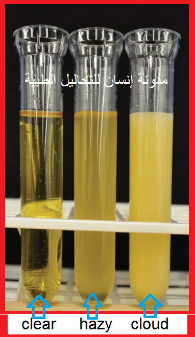 Physical Examination Of Urine Urine Clarity physical-examination-of-urine-urine-clarity