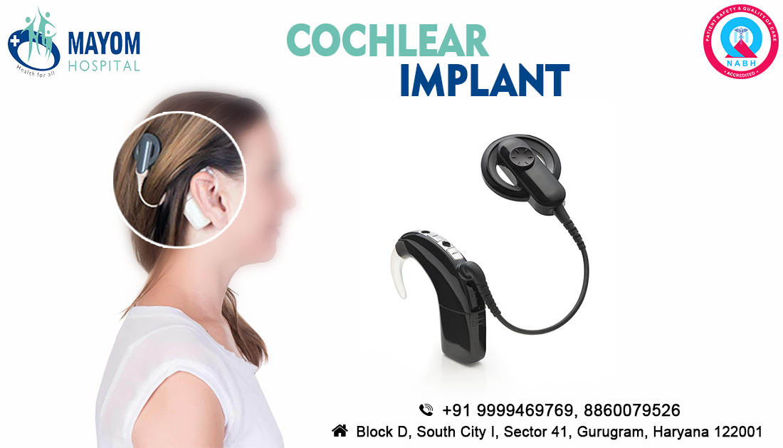 COCHLEAR IMPLANT