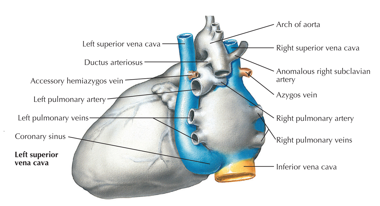 Medical Terms & Сlinical Сases : Left superior vena cava