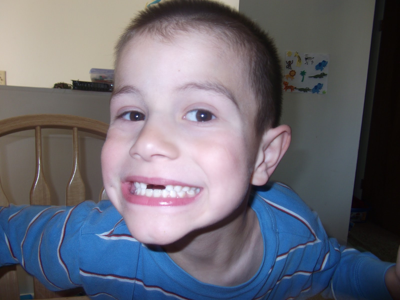 Carey Corner: My Two Front Teeth