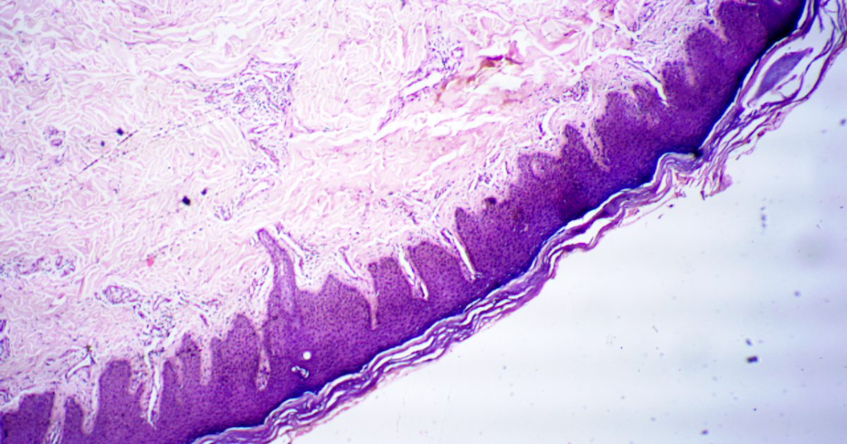 into the roots: Psoriasiform reaction pattern