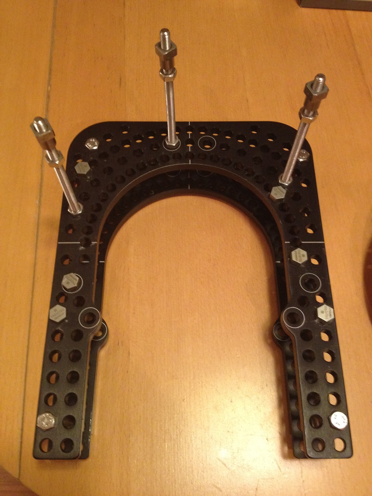 fibular hemimelia leg lengthening: Thigh Ring and Foot Plate removal ...