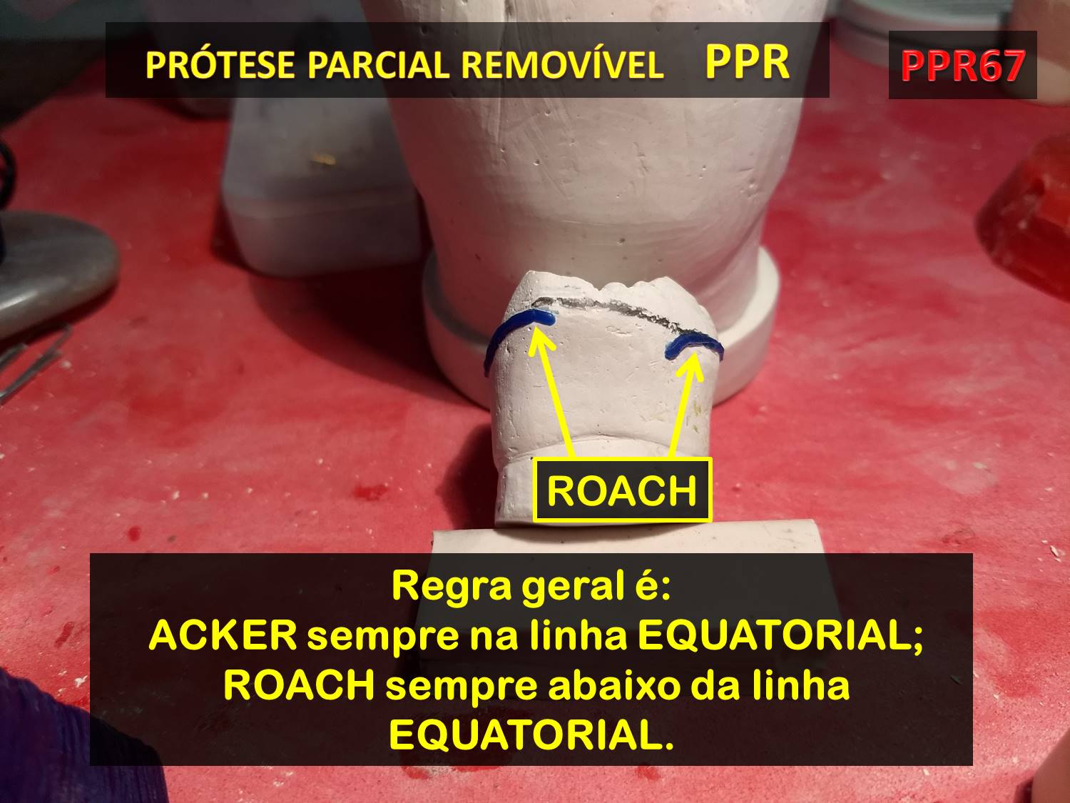 Professor Gilmar Zukowski gilmarprotese.blogspot.com : 3ºANO PPR ...