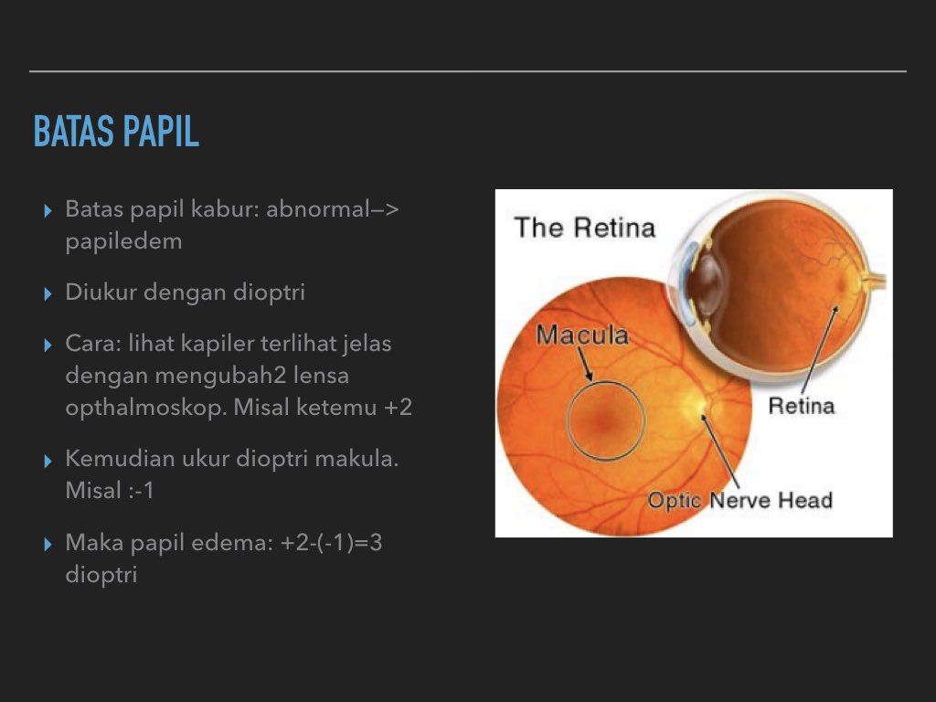 Cara ukur: dioptri_papil_ edema