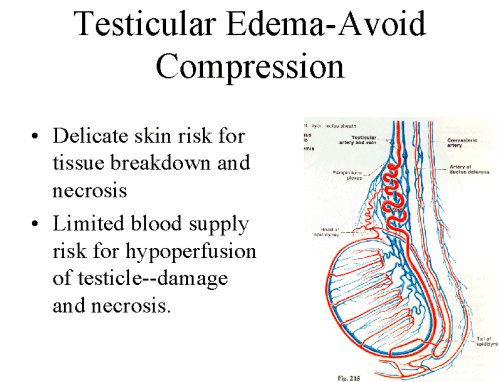 Smart Doctors: Chronic edema of the scrotum