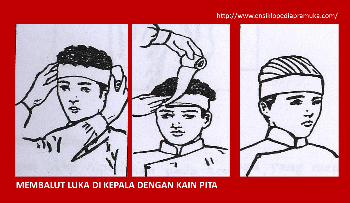 PPPK : Teknik Pembalutan