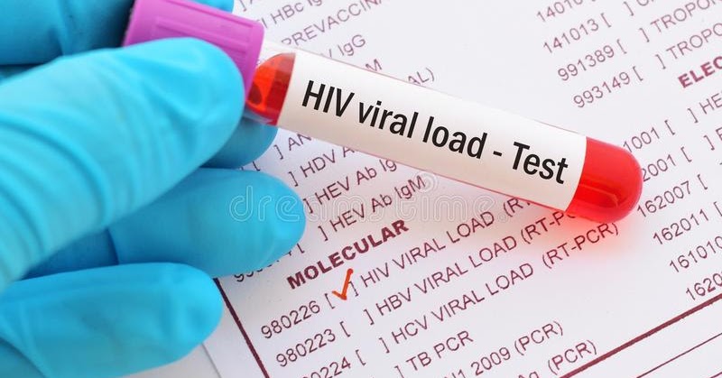 Our Goal: Undetectable Viral Load ~ Living with HIV in the Philippines