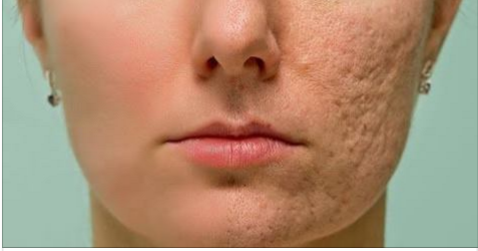 Rub This On Any Scar,Wrinkle Or Stain You Have On Your Skin And Enjoy ...