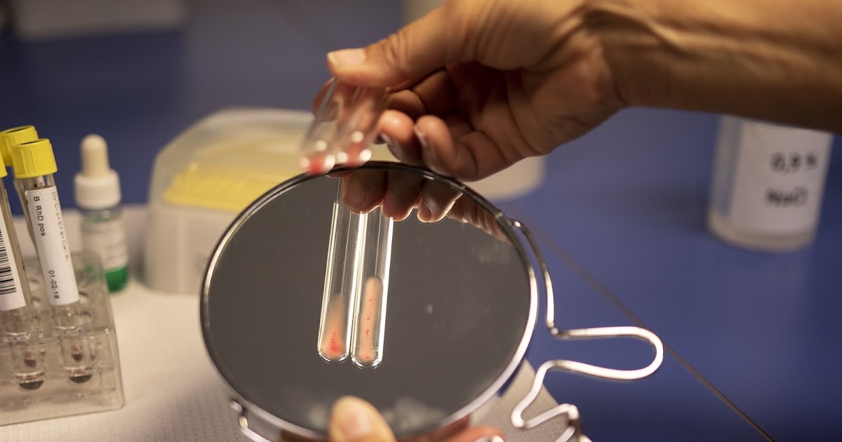 STANDARD OPERATING PROCEDURE FOR GENERAL SAFETY IN MICROBIOLOGY ...