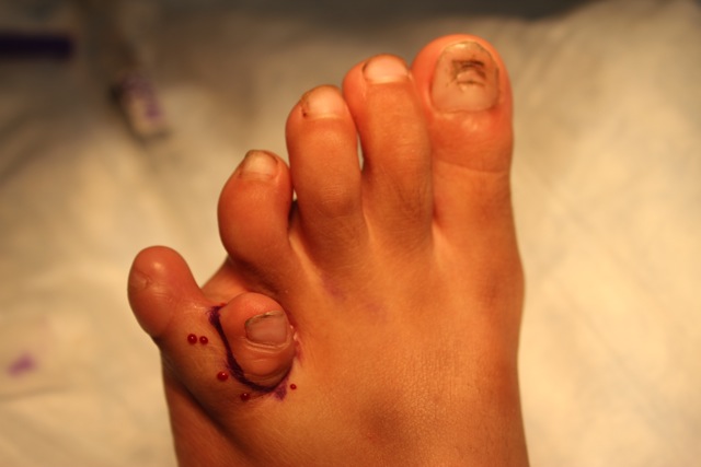 Women For World Health