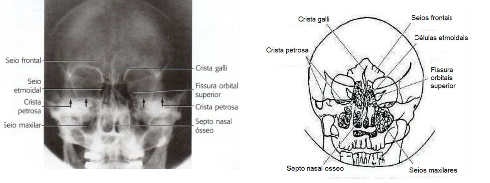 Laboratório de Roentgen: Crânio e Face