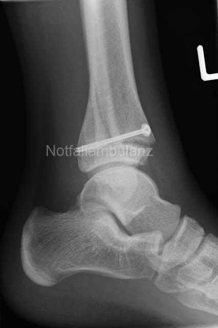 Brennpunkt Notaufnahme: Fall 16: Kindliche Distorsion des ...