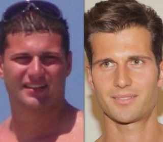 THE IMPORTANCE OF A STRONG JAWLINE - HOW TO ACHIEVE ONE