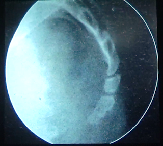 RADIOANATOMIA: CLASE 9