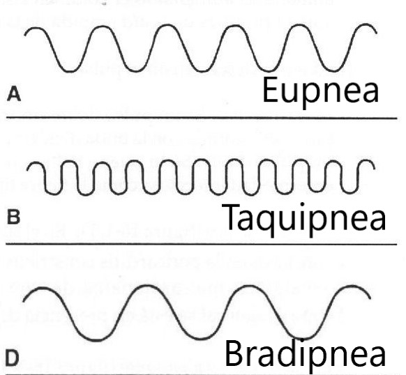 Teaching Nursing: Respiración: Técnica y Alteraciones (frecuencia y ritmo)